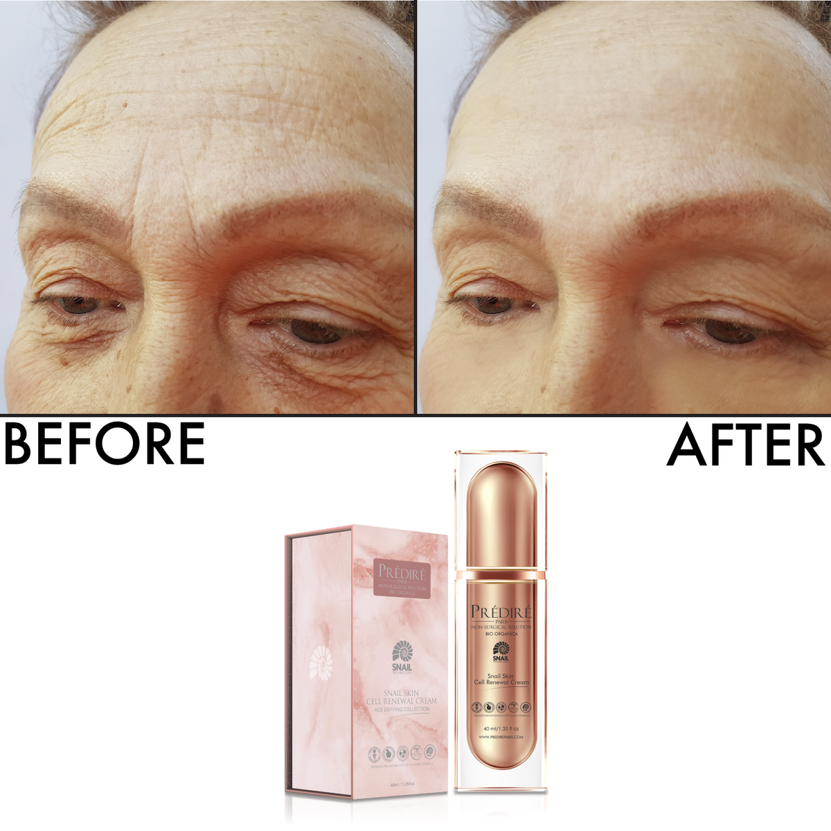 Snail Skin Concentrate Collection (Bundle) – Prédiré Paris Mexico